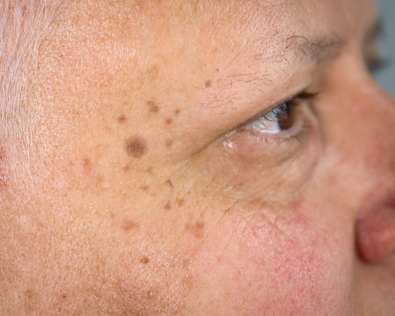 Age marks – Kitchen Makeup